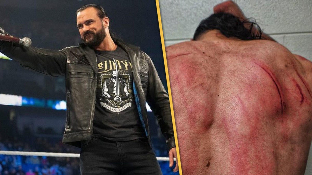 WWE's Drew McIntyre Shares Brutal Photo of Back After Roman Reigns ...